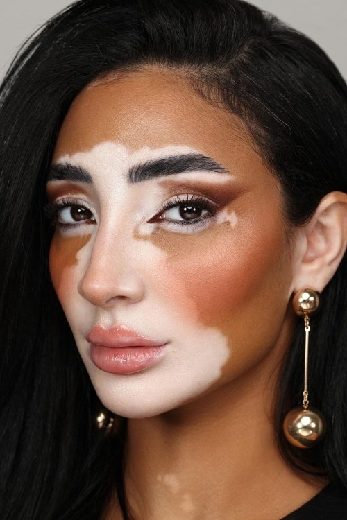 Mengenal Logina Salah, Kontestan Miss Universe Pertama yang Mengidap ...