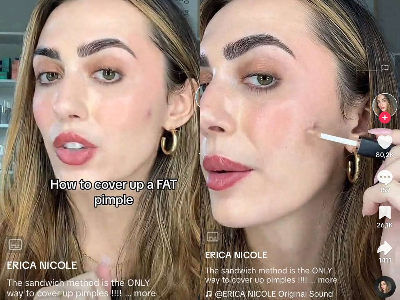 Sandwich Makeup Method, Metode Makeup untuk Bantu 'Hilangkan' Jerawat ...