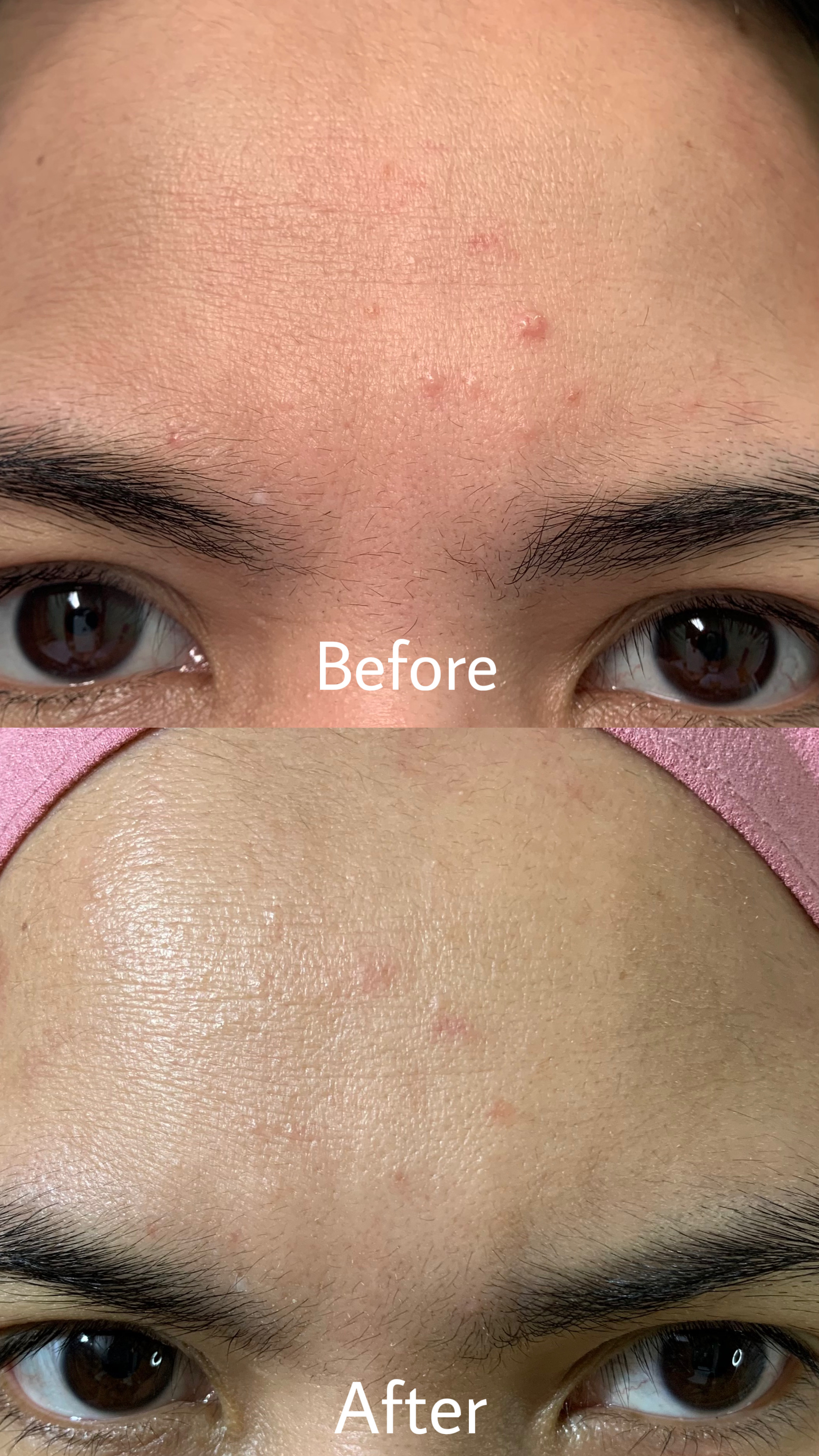 staciadani | stacia andani - SOCO by Sociolla