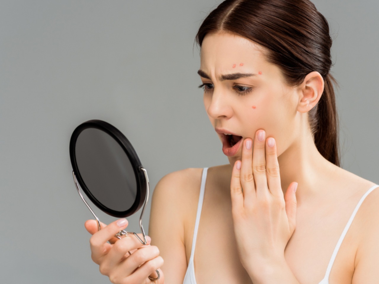 Menjengkelkan dan Bisa Meninggalkan Bekas, Begini Tips Mengatasi ...