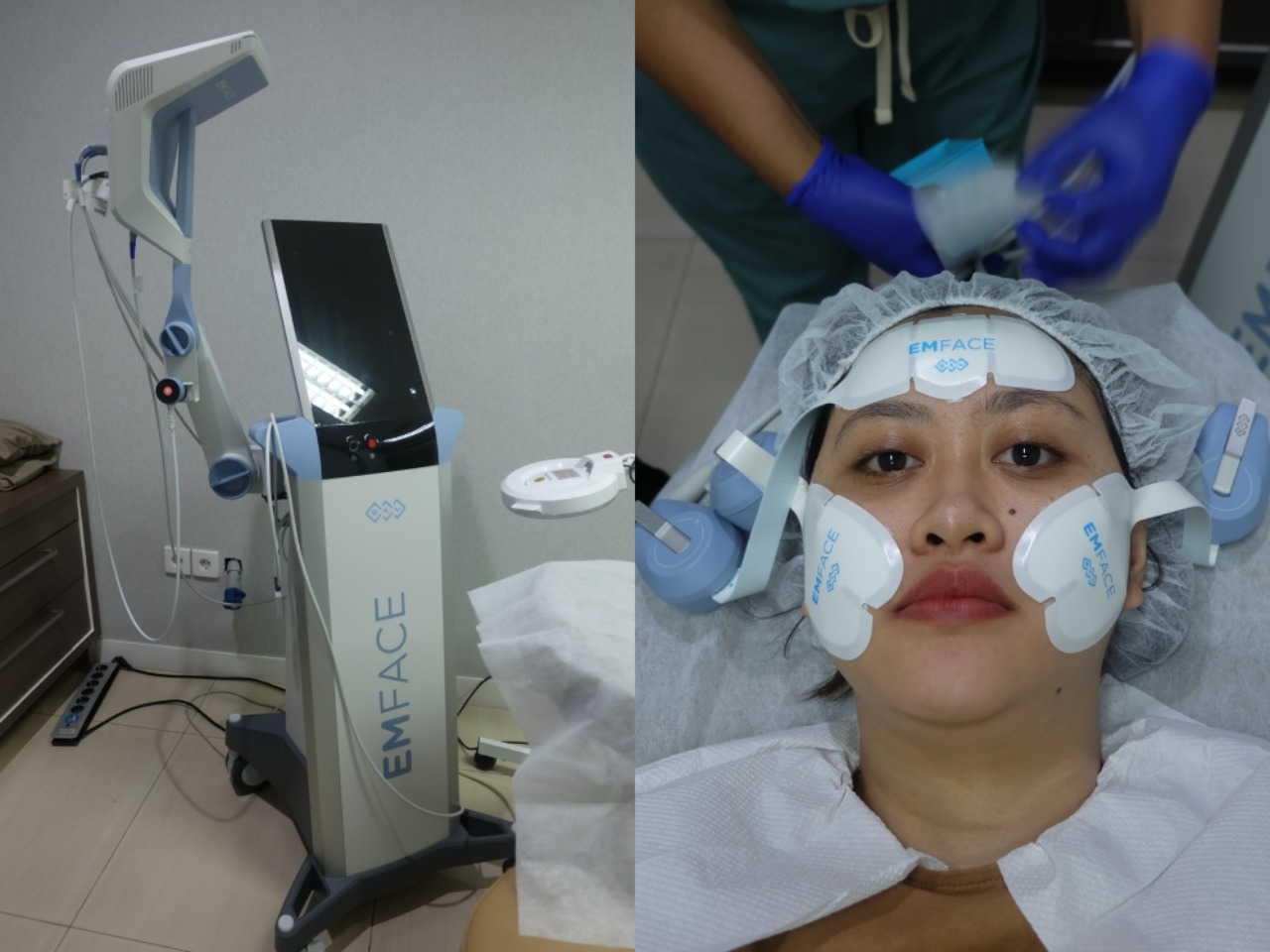 Review: EMFACE di Miracle Ultimate, Treatment Skin Lifting yang Menargetkan Otot Tanpa Rasa ...