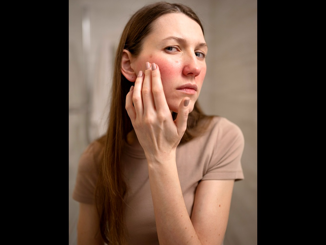 10 Kondisi Kulit yang Bisa Membuat Kulit Menjadi Kemerahan & Perlu ...