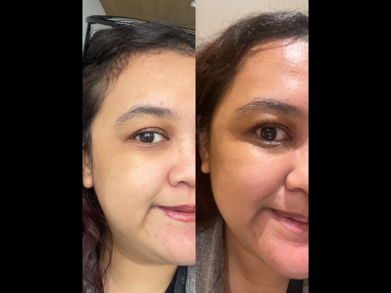 C Derma Perkenalkan Royal Enzyme Facial dari Ekstrak Buah Nanas ...