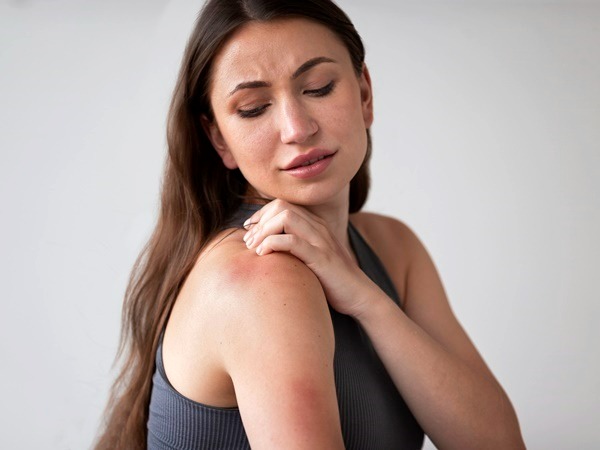 10 Kondisi Kulit yang Bisa Membuat Kulit Menjadi Kemerahan & Perlu ...