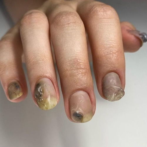 Tren Rotten Nails, Tampilan Kuku Anti-mainstream yang Tengah Viral di ...