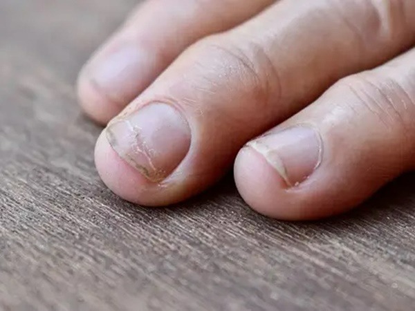 Perlu Kamu Tahu, Ternyata Ini Penyebab hingga Cara Mengatasi Infeksi ...