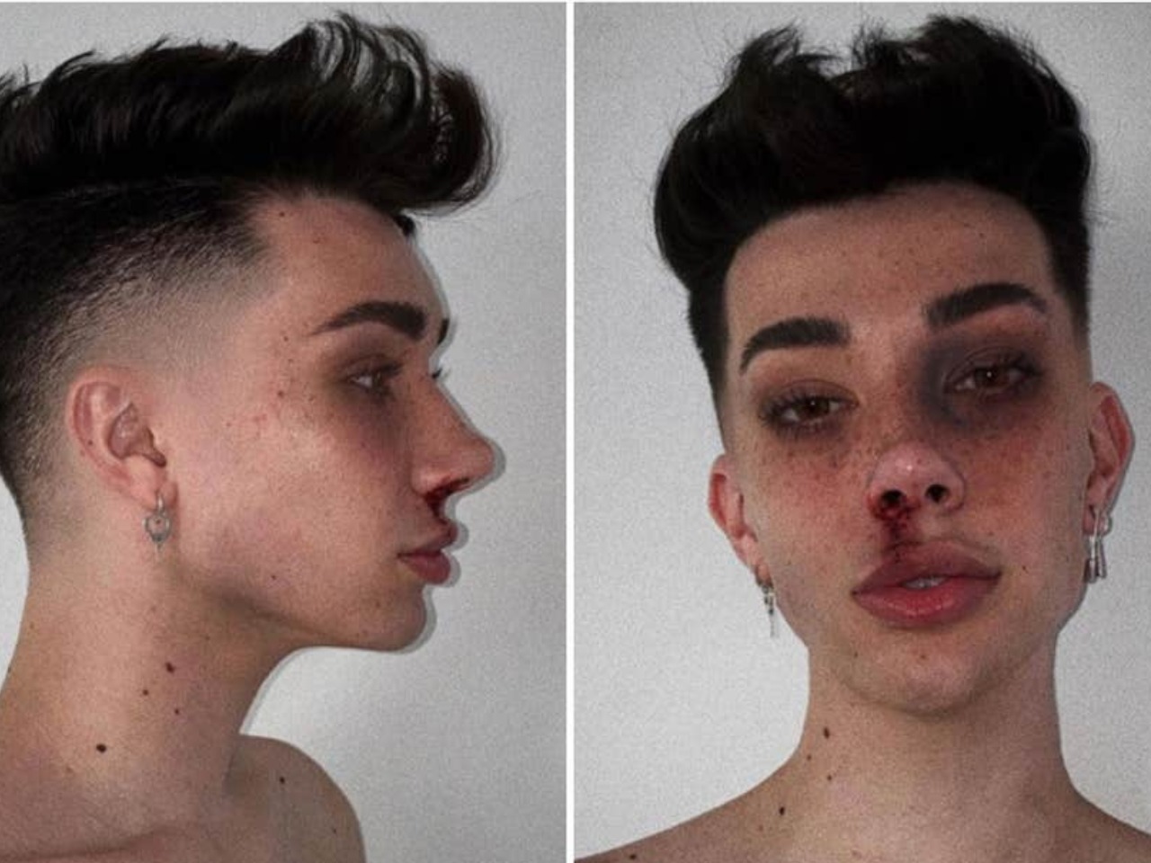 Mugshot Challenge, Tren Kontroversial yang Sempat Viral di Kalangan ...