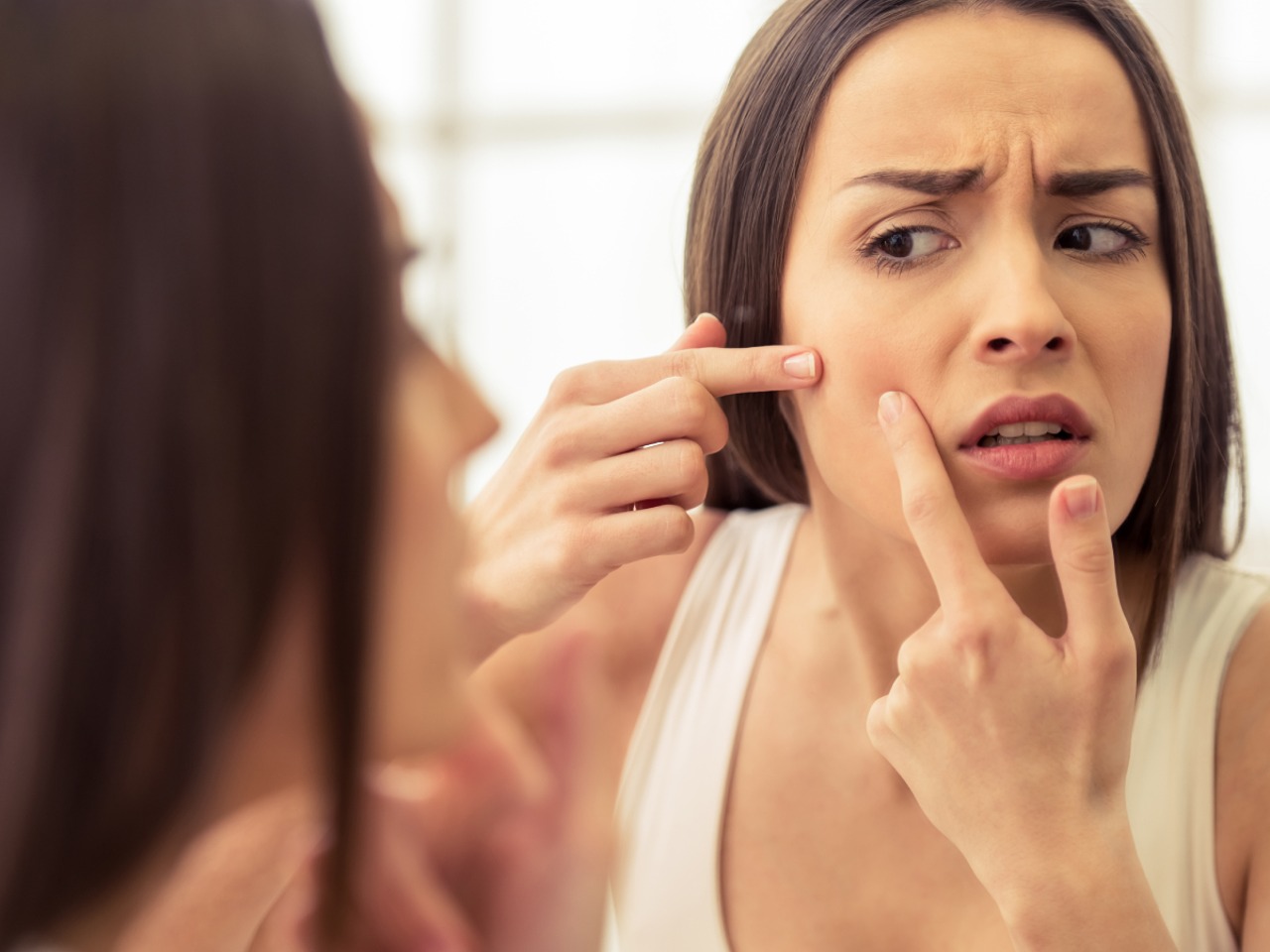 Penyebab dan Cara Mencegah Terjadinya Bopeng Bekas Jerawat Menurut ...