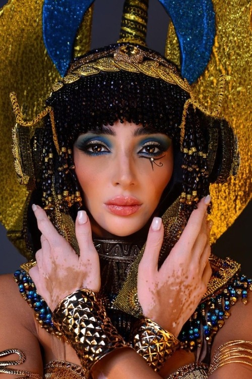 Mengenal Logina Salah, Kontestan Miss Universe Pertama yang Mengidap ...