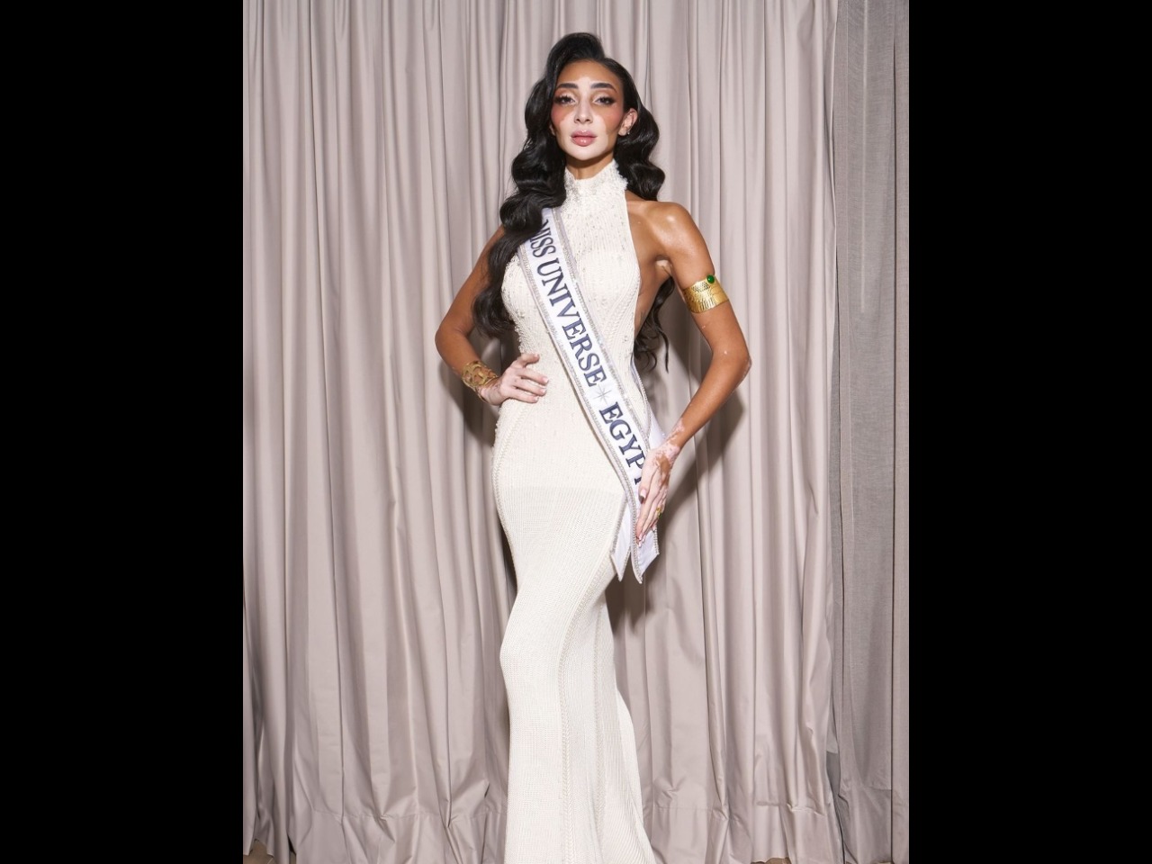 Mengenal Logina Salah, Kontestan Miss Universe Pertama yang Mengidap ...