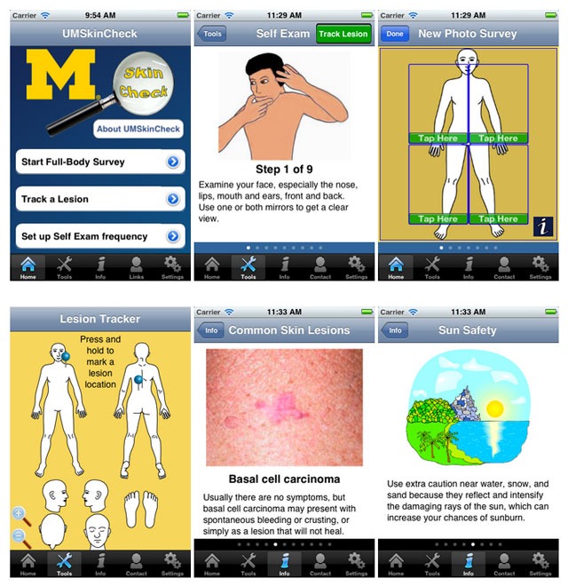 Yuk, Peduli Kesehatan Kulit dengan Lakukan Skin Check secara Mandiri ...