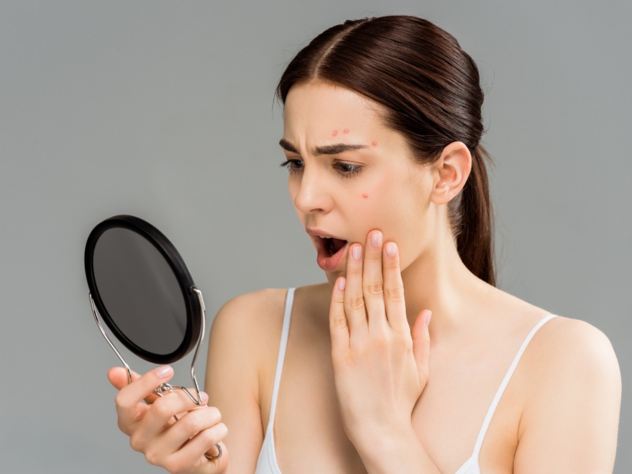 Berbagai Cara Mengatasi Jerawat dalam Waktu Singkat Menurut Dermatolog ...