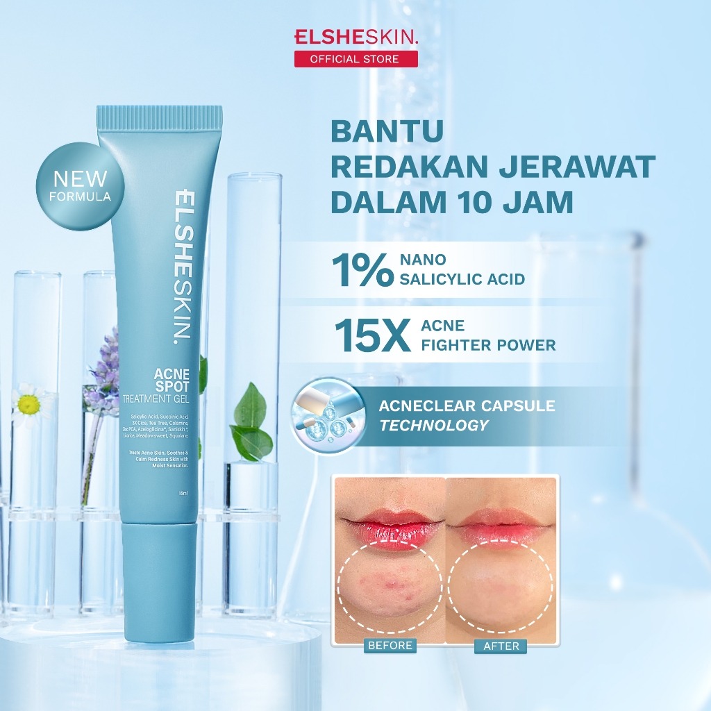 Yuk, Kenalan dengan ELSHESKIN Acne Care Series yang Bisa Merawat hingga ...