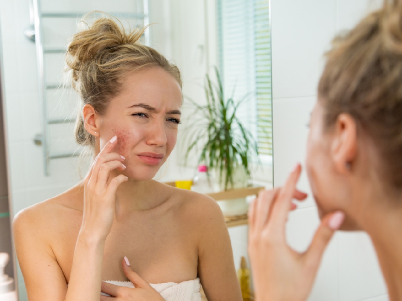 Tingling Sensation, Apa Benar Tanda Saat Produk Skin Care Sedang ...