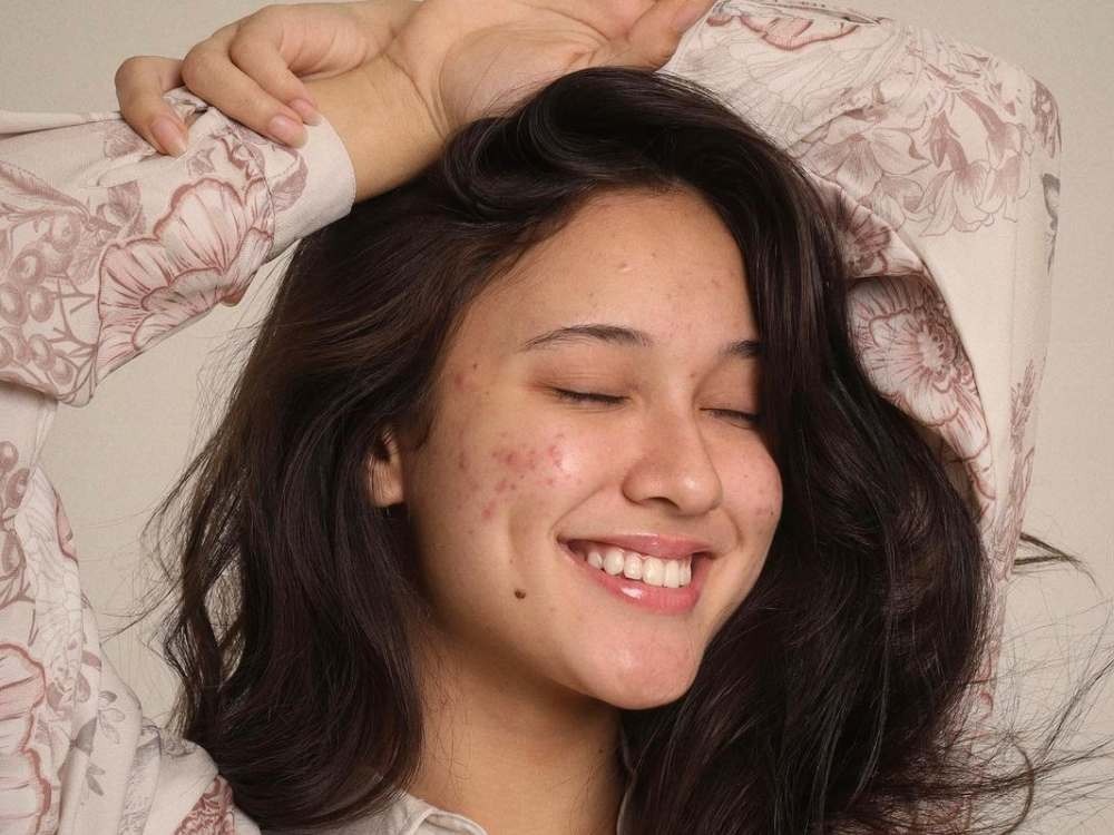 Beri Semangat untuk Acne Fighter, Intip Berbagai Makeup Look Yasmin ...