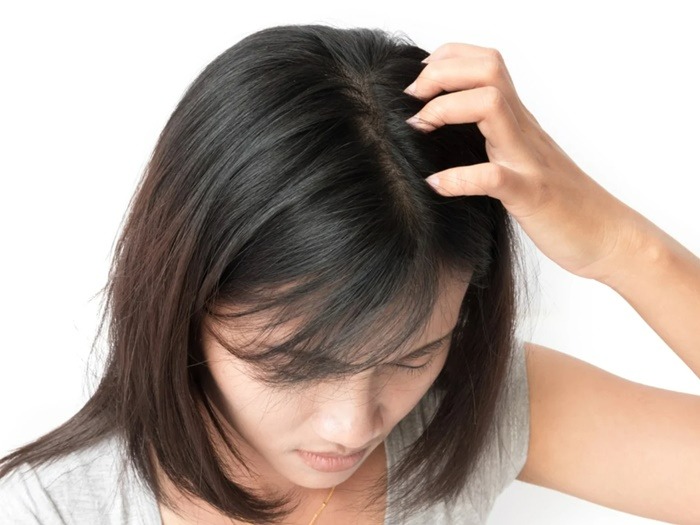 Mengenal Lebih Dalam Manfaat Scalp Microbiome untuk Kesehatan Rambut ...