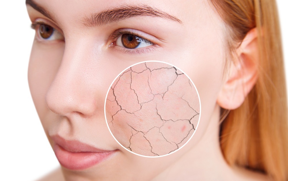 ELSHESKIN 101: Panduan Memilih Rangkaian Skin Care ELSHESKIN Sesuai ...