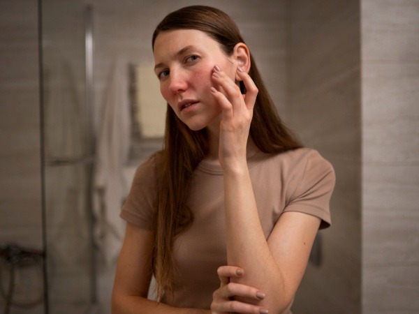 Ask the Expert: Cara Menggunakan Niacef Gel yang Aman & Tepat dari ...