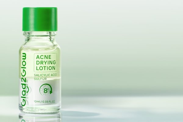 Jerawat Muncul Sebelum Momen Penting? Ini Obat Totol yang Bantu Redakan ...