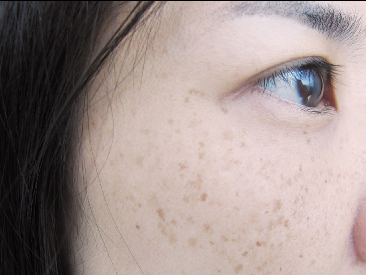 Punya Masalah Dark Spot? Berikut 5 Rekomendasi Serum untuk Mengatasinya ...