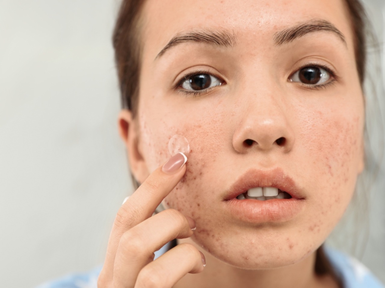 Mulai dari Mencegah hingga Mengatasi, Ini Rangkaian Produk Skin Care ...