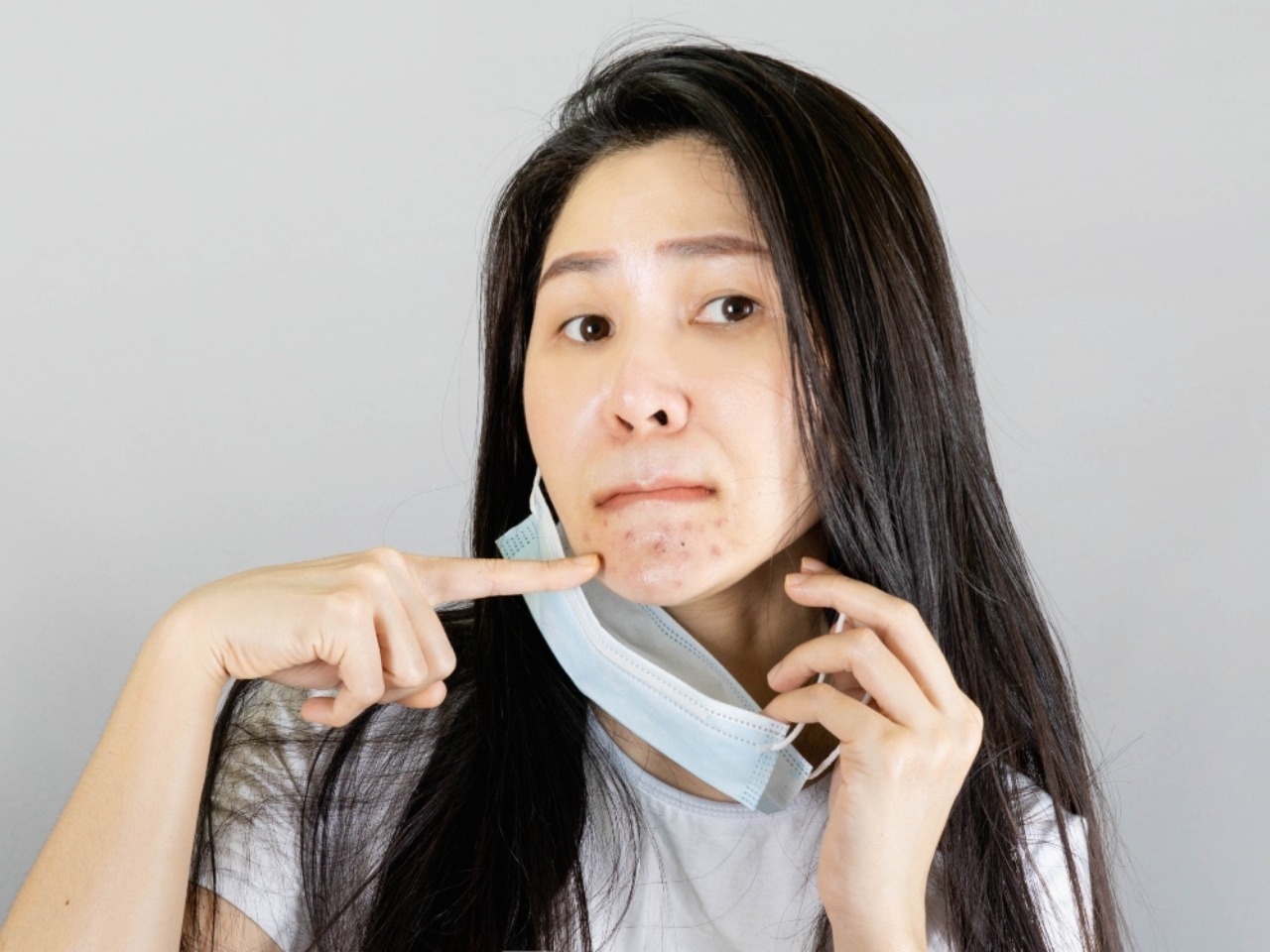 Ini 5 Cara yang Bisa Dilakukan agar Terhindar dari Mascne - Beauty Journal