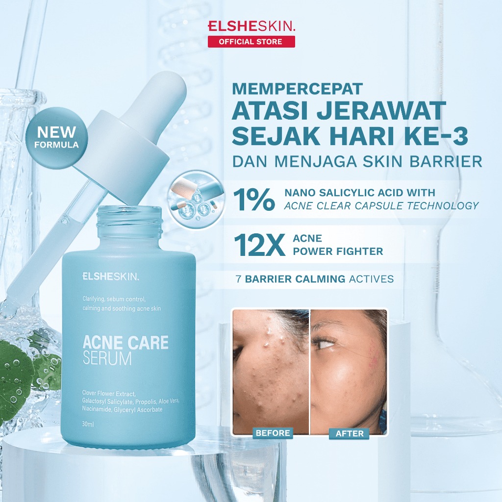 Yuk, Kenalan dengan ELSHESKIN Acne Care Series yang Bisa Merawat hingga ...