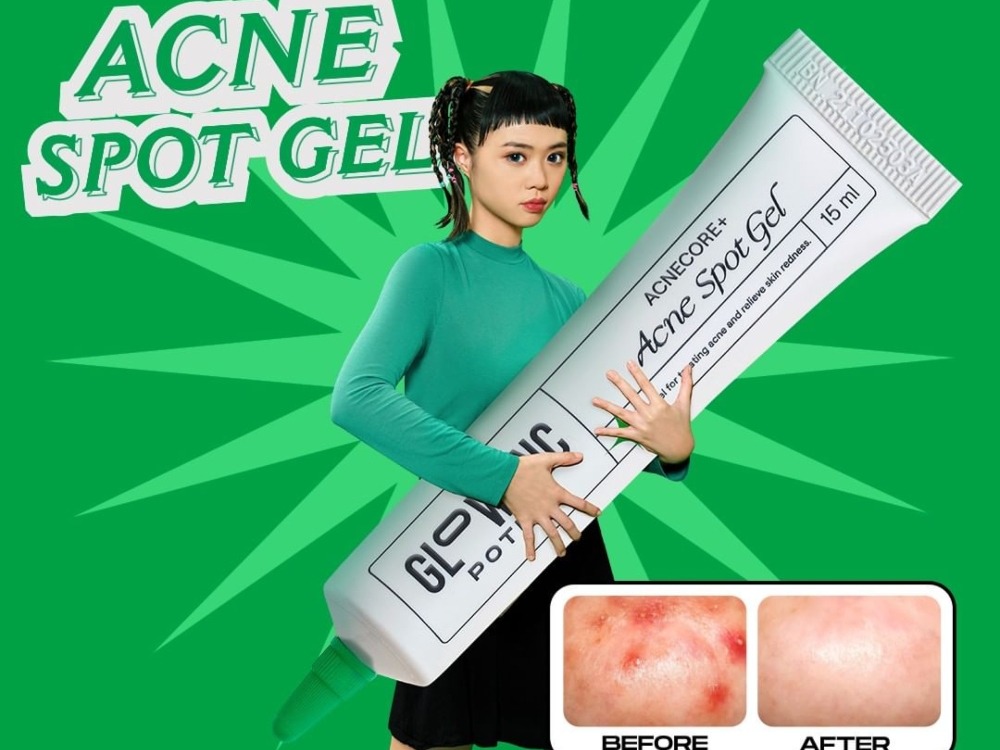 Mengandung Salicylic Acid hingga Sulfur, Ini Rekomendasi Acne Spot ...
