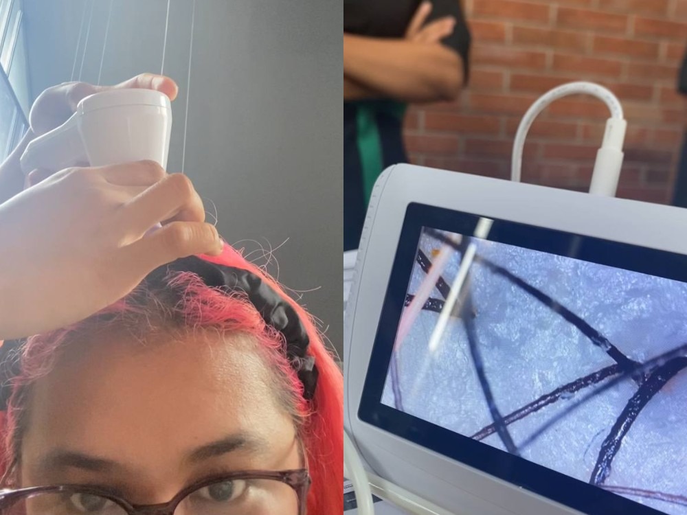 Fokus Atasi Masalah Rambut, Mylea Hair Care System Hadirkan Produk ...