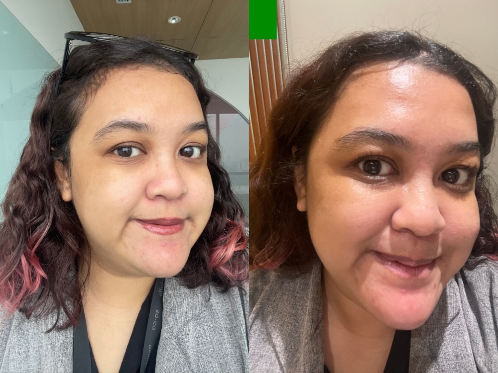 C Derma Perkenalkan Royal Enzyme Facial dari Ekstrak Buah Nanas ...