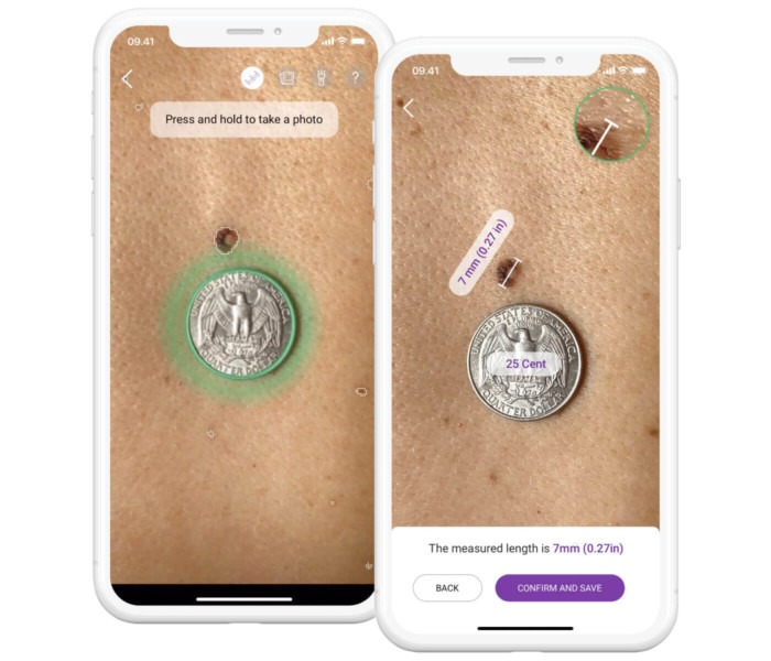 Yuk, Peduli Kesehatan Kulit dengan Lakukan Skin Check secara Mandiri ...