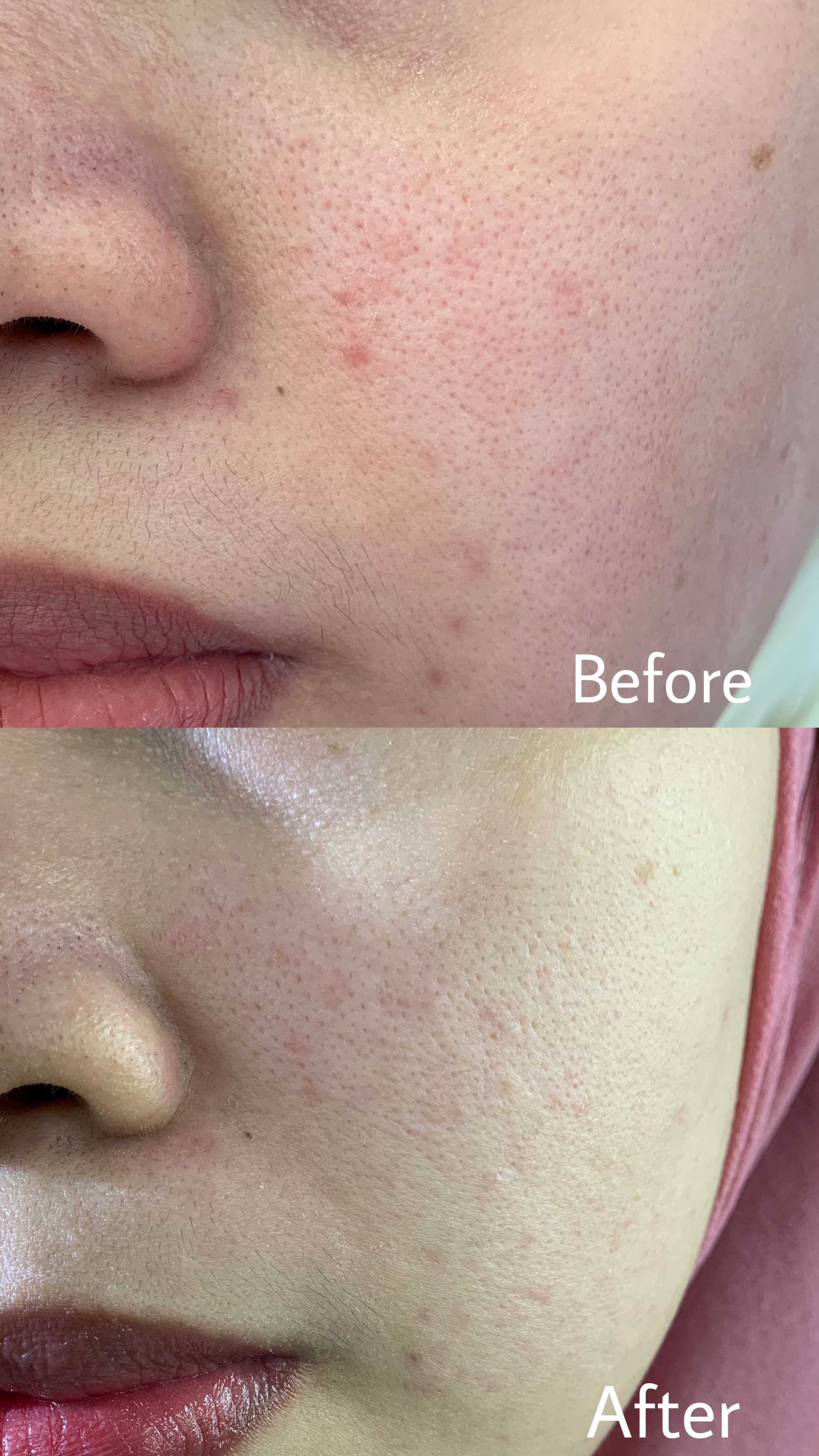 staciadani | stacia andani - SOCO by Sociolla